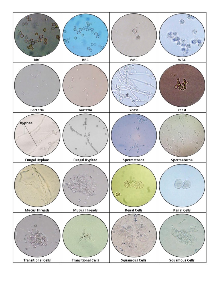 Urine Crystals | PDF