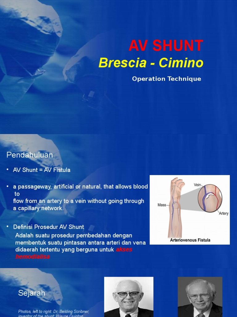 AV Shunt-Brescia Cimino - Edit | PDF | Vein | Chronic Kidney Disease