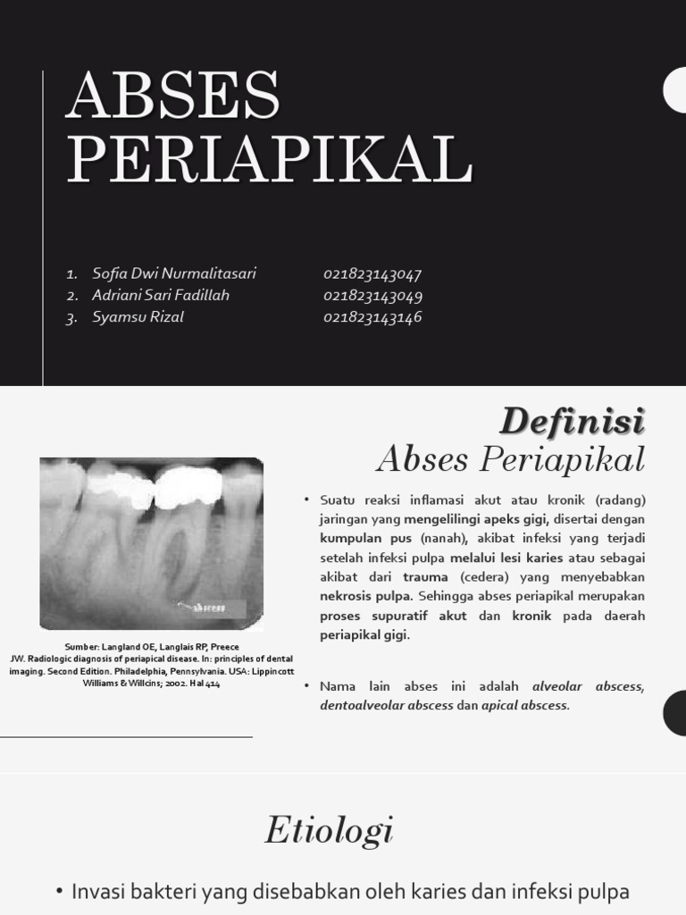 Abses Periapikal | PDF