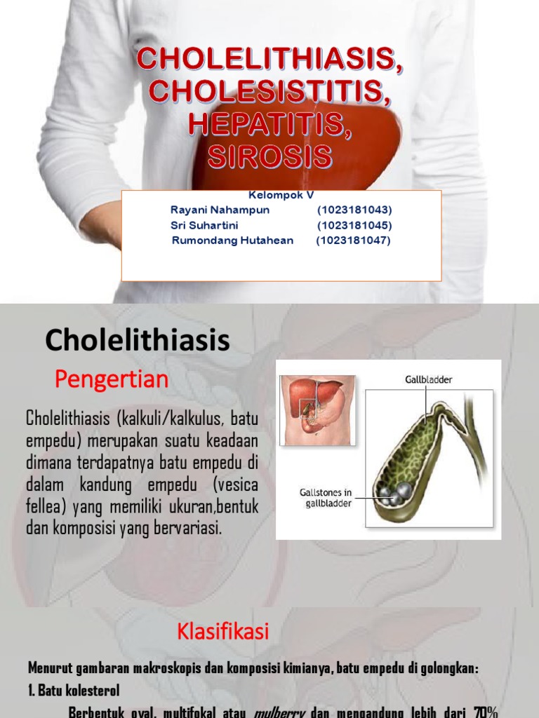 New PPT-CHOLELITHIASIS, CHOLESISTITIS, HEPATITIS, SIROSIS | PDF