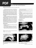 Failures in FPD | PDF | Dentistry | Mouth