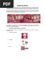Proceso Alveolar | PDF | Hueso | Anatomía