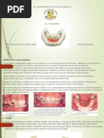 Tipos de Expansores en Ortodoncia | PDF | Ortodoncia | Ramas de Odontología