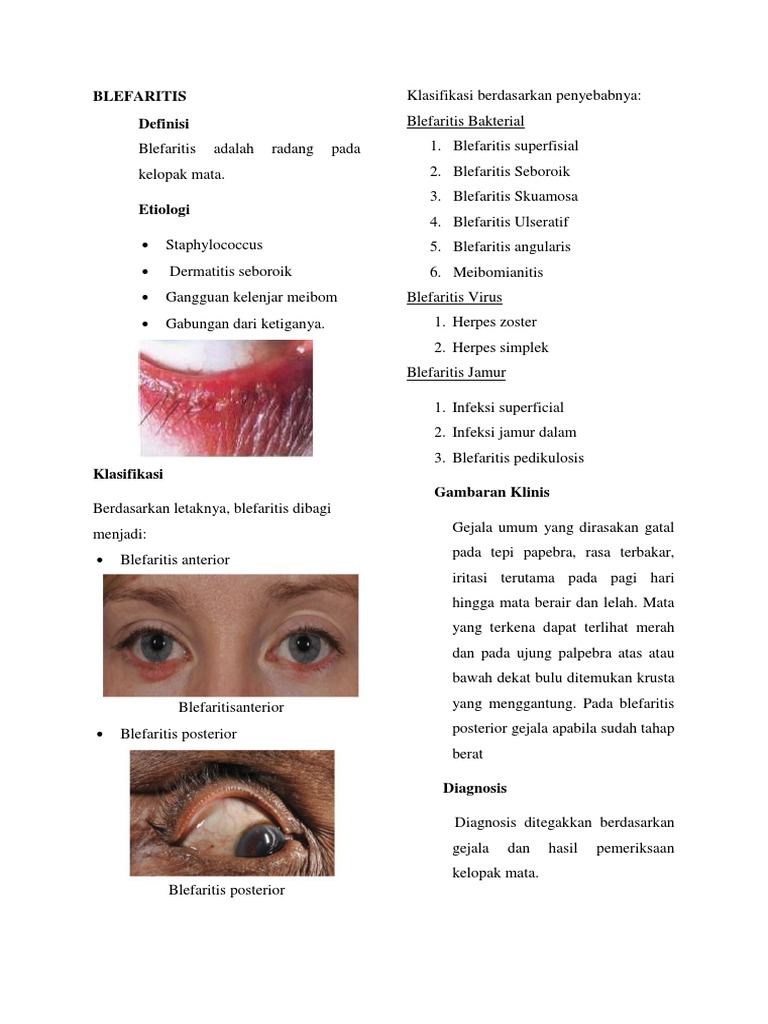 Pret Test Mata | PDF