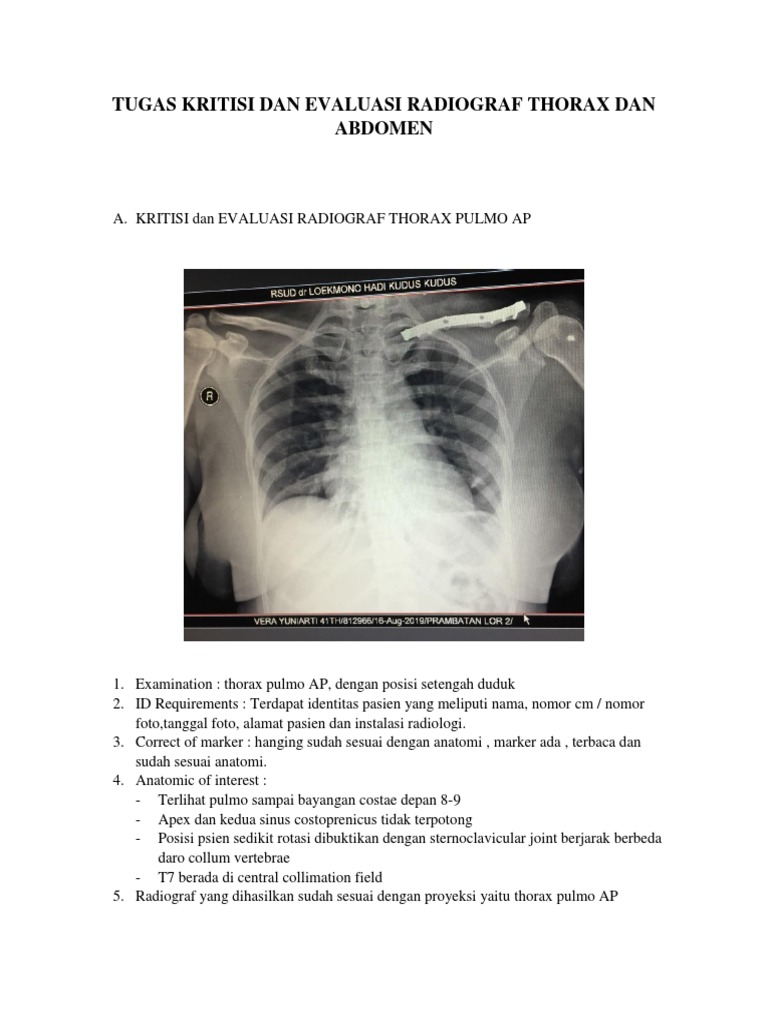 Tugas Kritisi Dan Evaluasi Radiograf Thorax Dan Abdomen | PDF