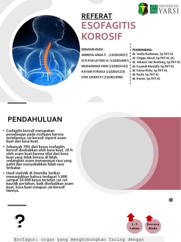 Esofagitis Korosif: Penyebab dan Penanganan | PDF