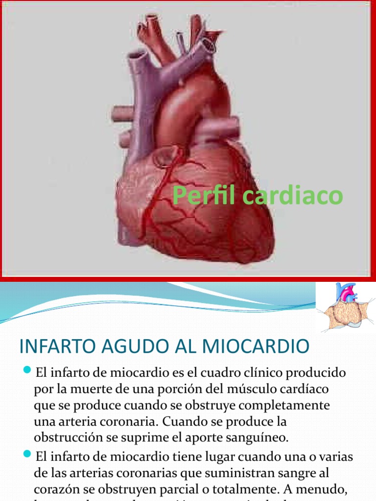 Perfil Cardiaco | PDF | Transaminasa | Infarto de miocardio