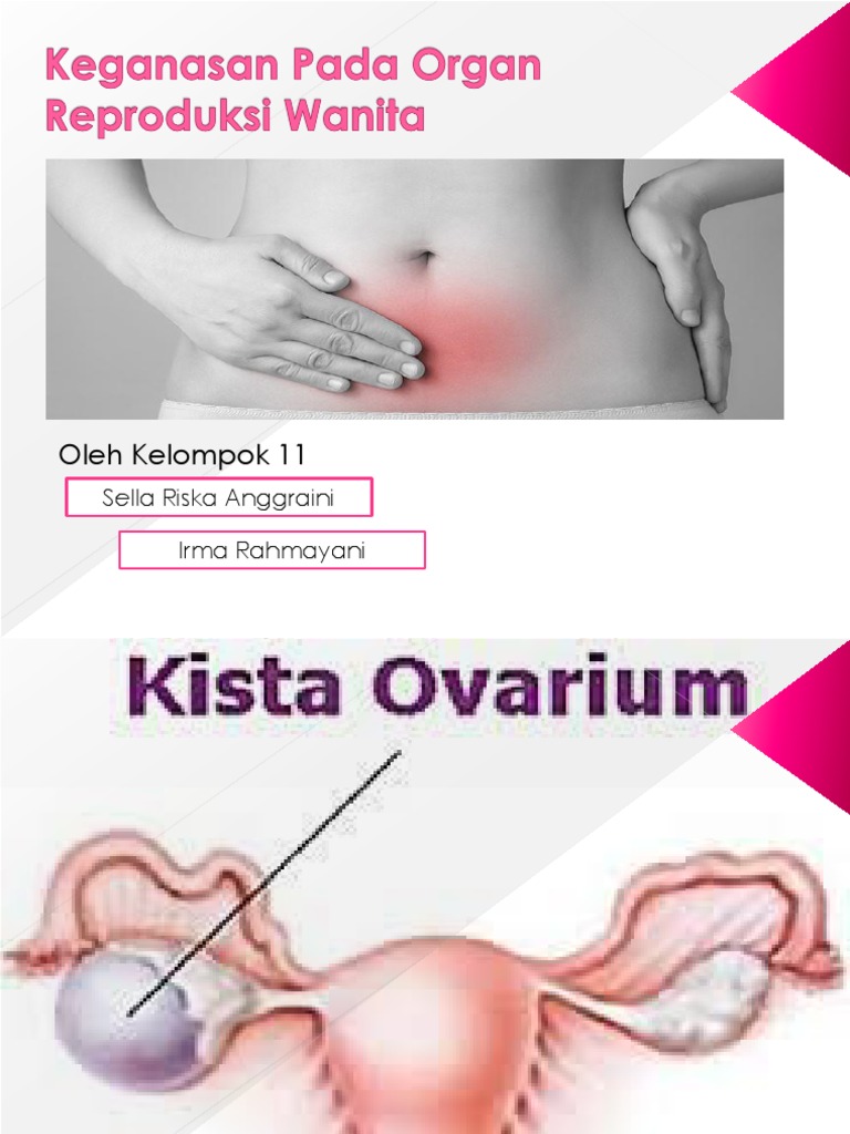 SAP Kista Ovarium | PDF