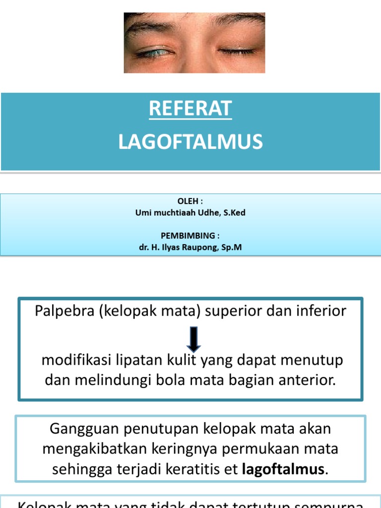 Lagoftalmus | PDF