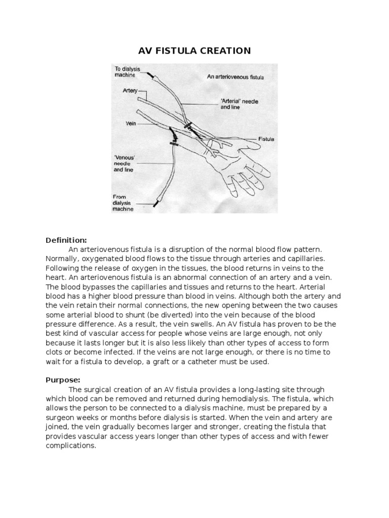 Av Fistula Creation | Hemodialysis | Medical Procedures