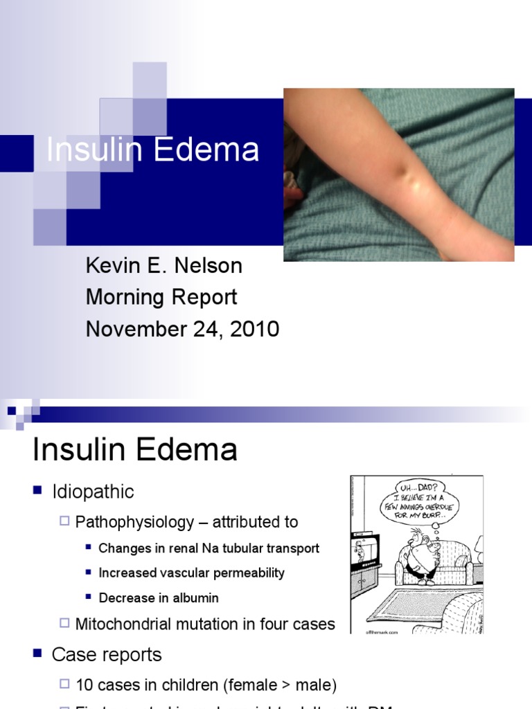 Insulin Edema 11.24.2010 | PDF