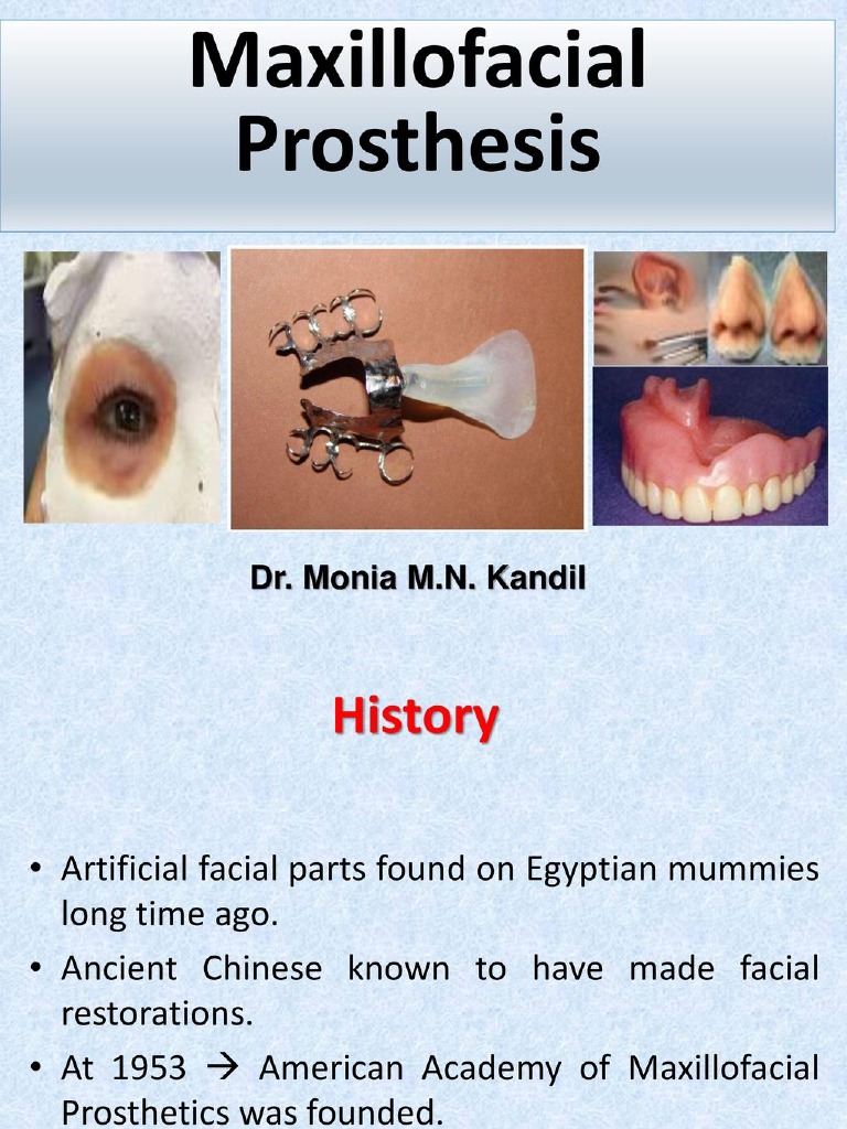 Maxillofacial Prosthesis PDF | PDF