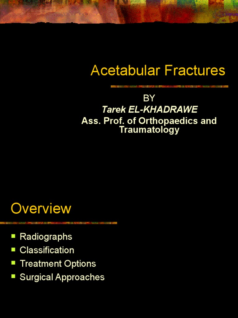 Acetabular Fracture Classification and Management | PDF | Anatomical ...