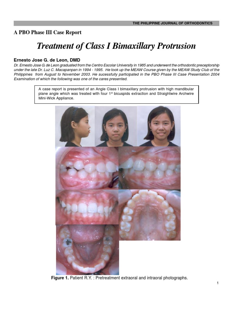 Ortho Case Report | PDF | Orthodontics | Face