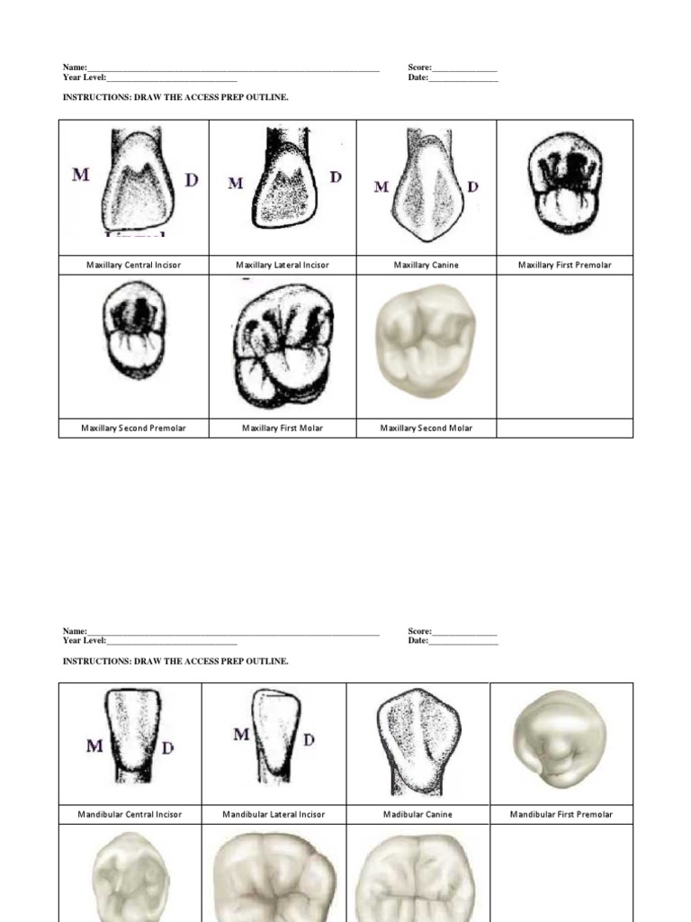 Access Prep Outline for Teeth | PDF