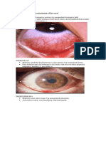 Beda Injeksi Konjungtiva Dan Siliar | PDF | Ilmu Sosial