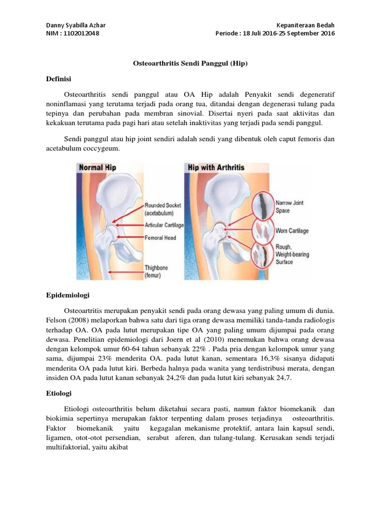 Osteoarthritis Sendi Panggul | PDF