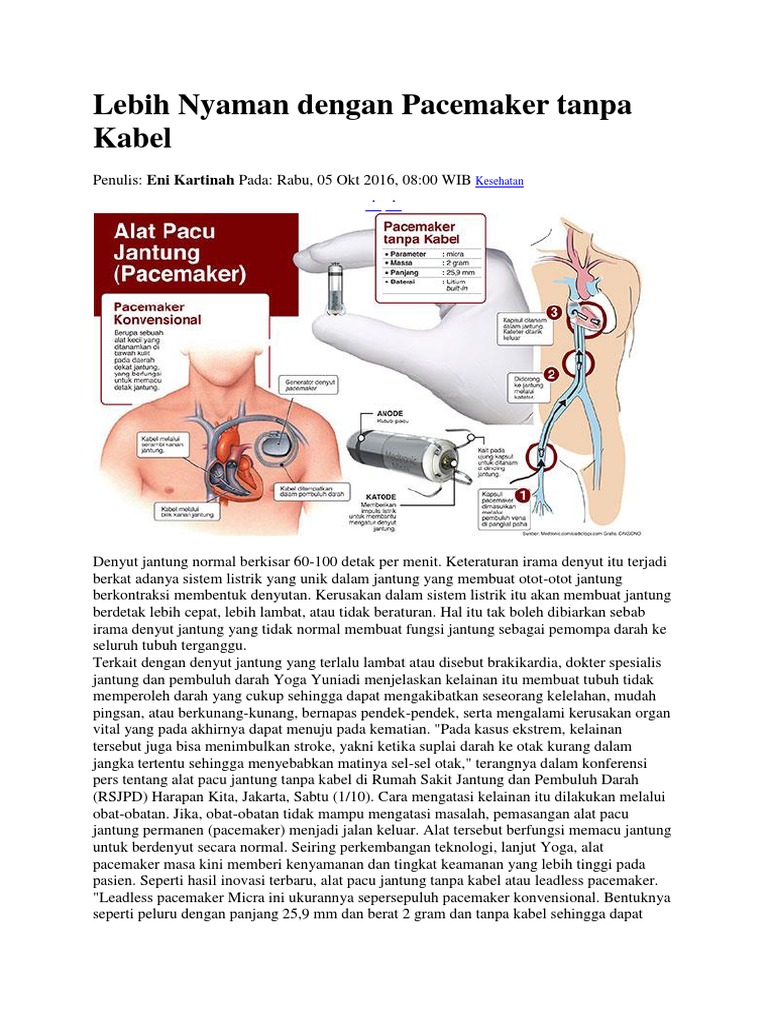 Pacemaker Pdf