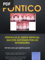 TiPos D Ponticos | PDF | Diente