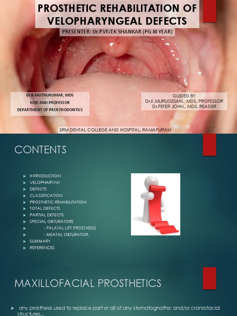 Velopharyngeal Defects | PDF | Prosthodontics | Prosthesis