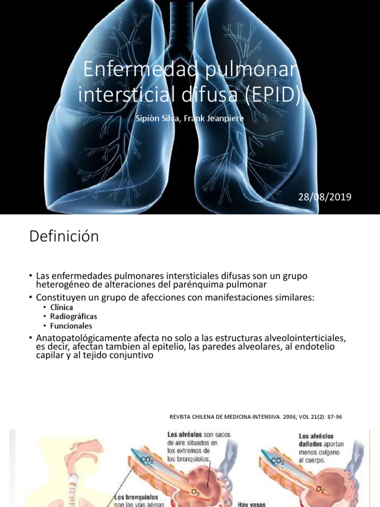 Enfermedad Pulmonar Intersticial Difusa | PDF | Inflamación | Nicotina