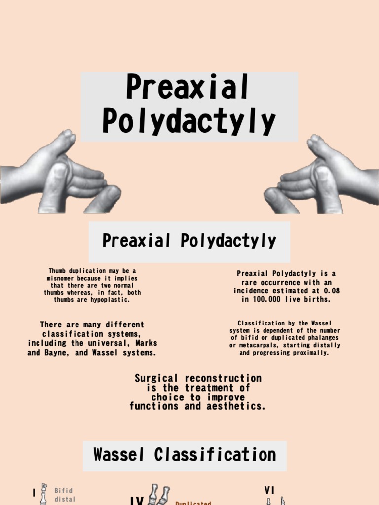 Preaxial Polydactyly Reconstruction | PDF | Thumb | Hand