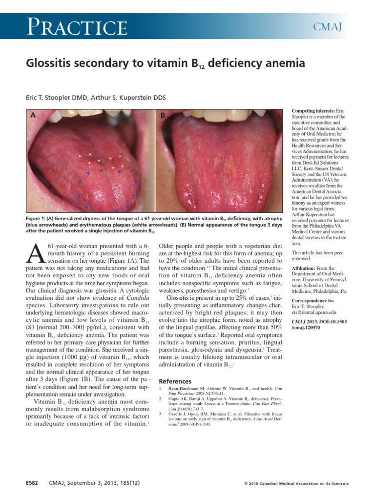 Glositis PDF | Download Free PDF | Medical Specialties | Clinical Medicine