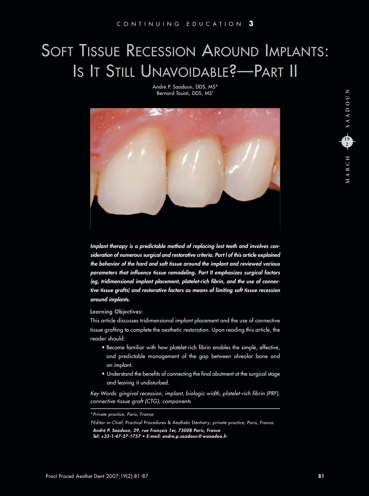 Soft Tissue Recession Around Implants | PDF | Dental Implant | Dentistry