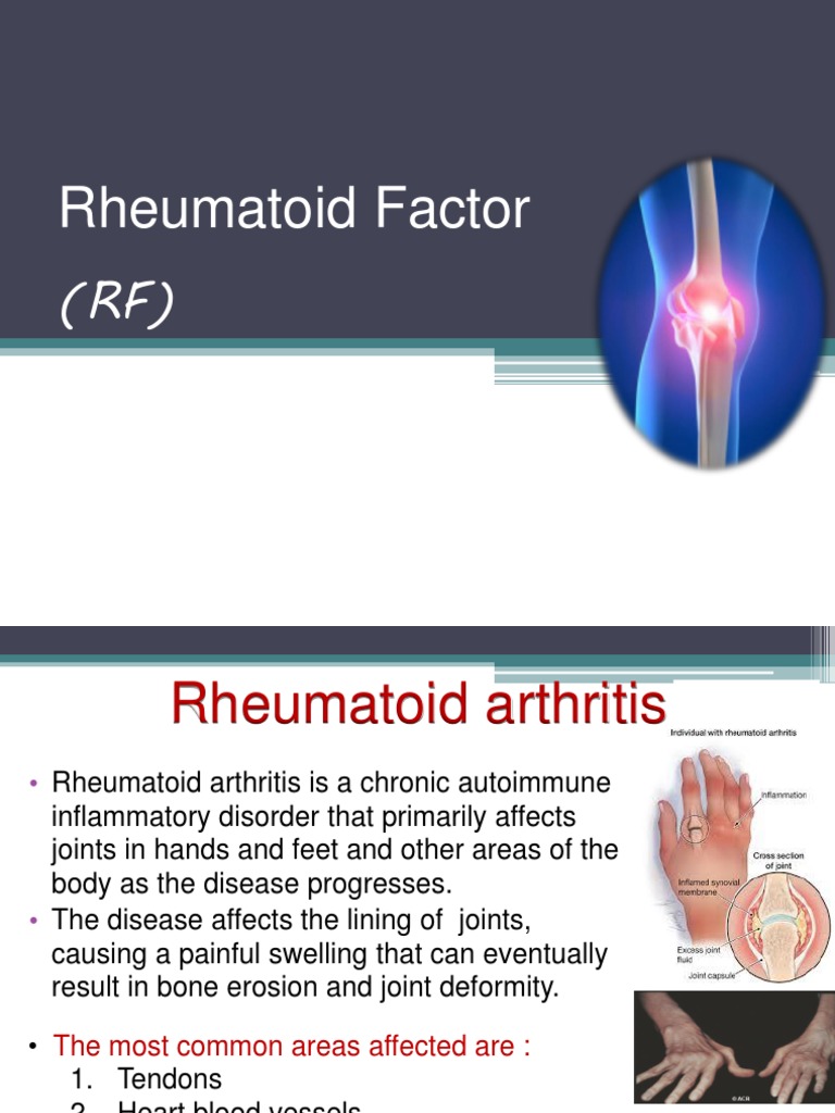 Rheumatoid Factor | PDF | Rheumatoid Arthritis | Arthritis