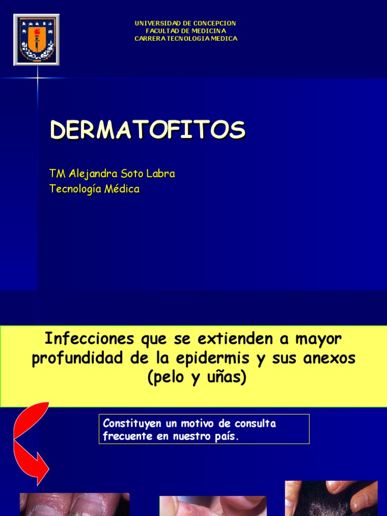 Dermatofitos | PDF | Condiciones cutáneas | Ciencias de la Salud