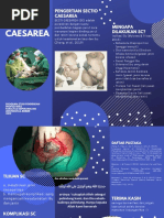 Laporan Pendahuluan Sectio Caesarea | PDF
