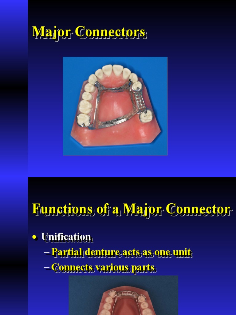 Mandibular Major Connectors | PDF | Dentures | Mouth