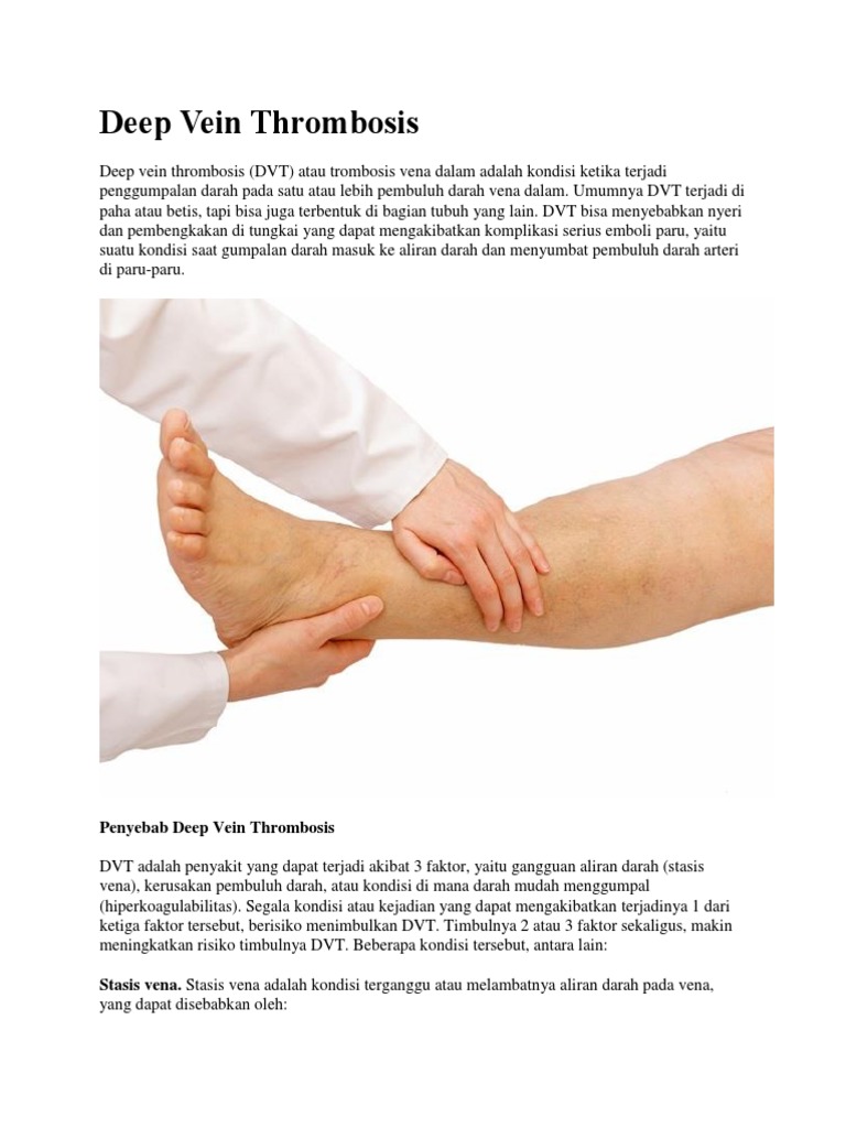 Deep Vein Thrombosis | PDF | Sains & Matematika