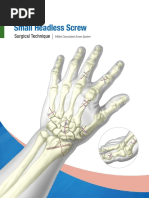 Acumed Screw & Pin Fixation Guide | PDF | Screw | Drill