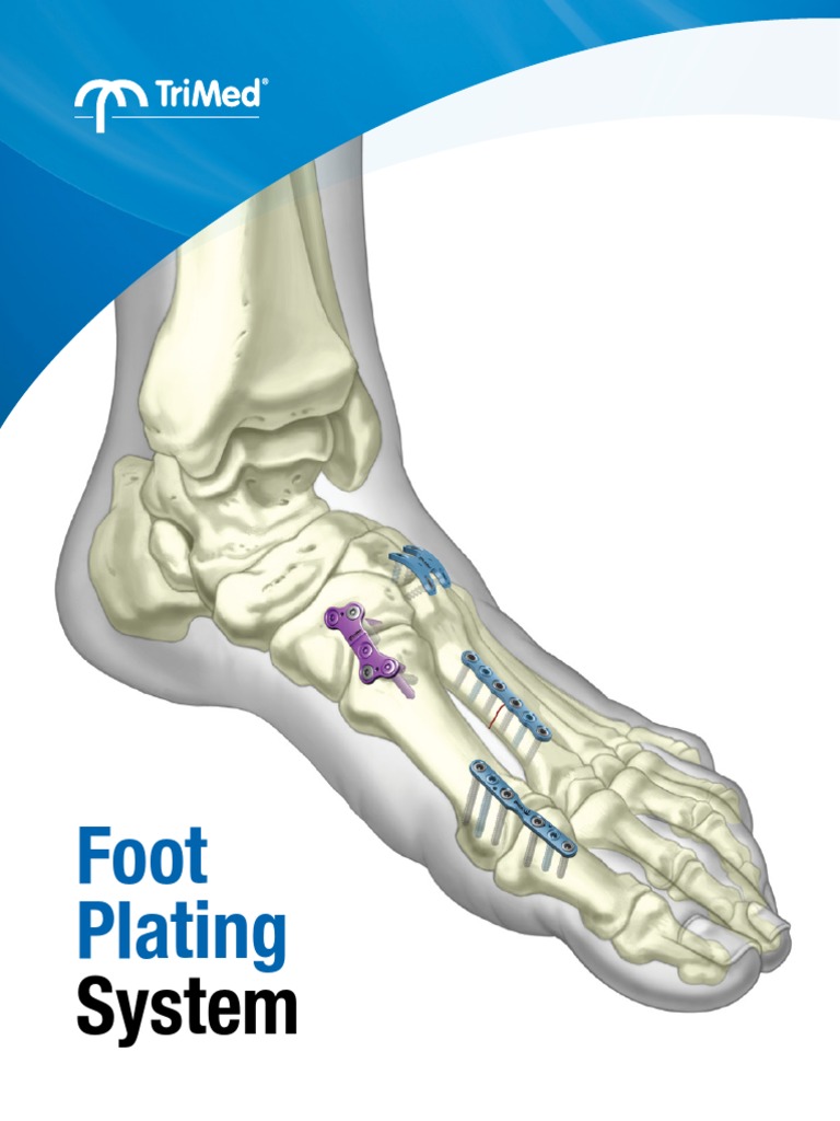 System Brochure - Foot Plating System PDF | PDF | Drill | Skeletal System