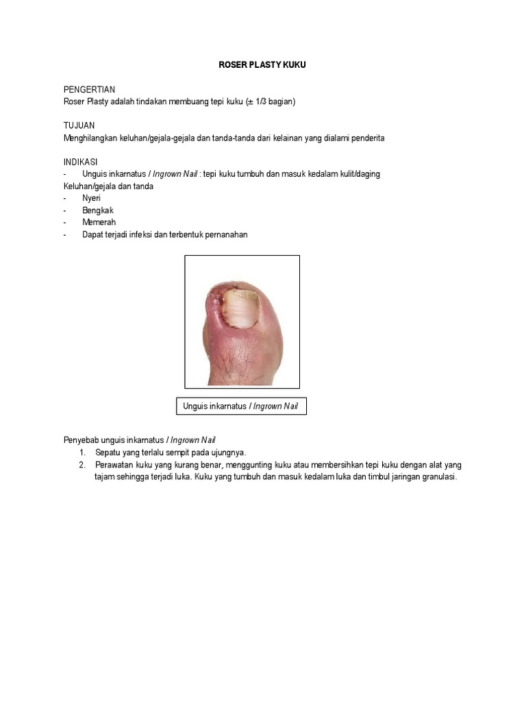 Roser Plasty Kuku | PDF