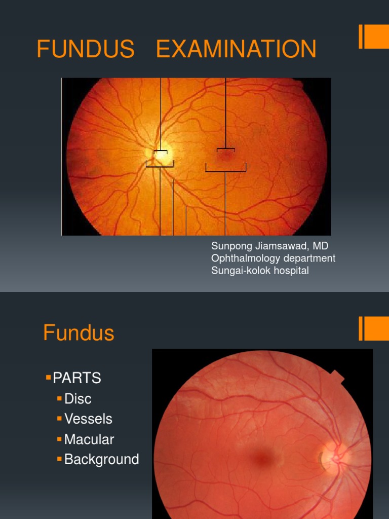 Fundus Exam Hat | PDF | Science & Mathematics