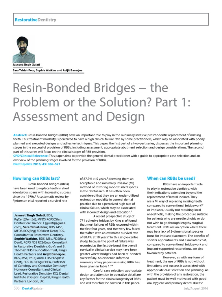 Dent Update 2016 Resin-Bonded-Bridge-Design | PDF | Dental Composite ...