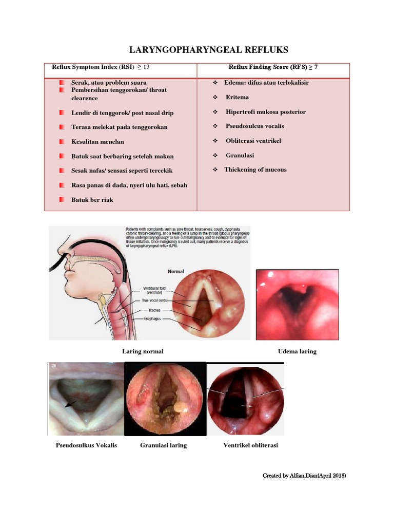 Reflux Symptom Index | PDF | Larynx | Otorhinolaryngology