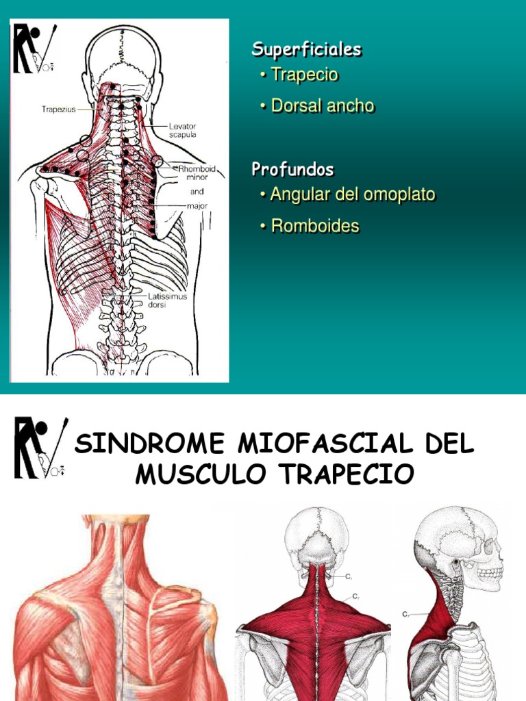 Anatomía Del Trapecio Anatomía Completa Músculo TRAPECIO