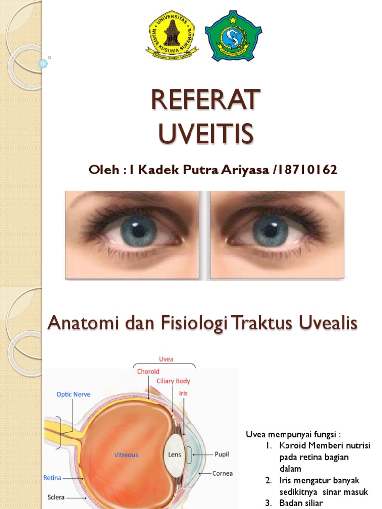 Referat Uveitis | PDF