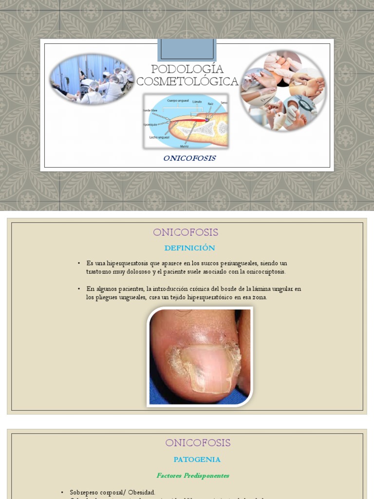 PATOLOGÍAS PODOLÓGICAS MÁS FRECUENTES ONICOFOSIS.pdf