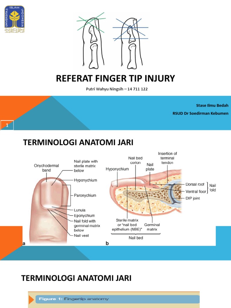 Tugas Ortho Fingertip Injury PDF | PDF