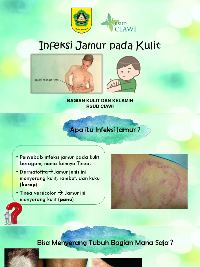 Infeksi Jamur Pada Kulit | PDF