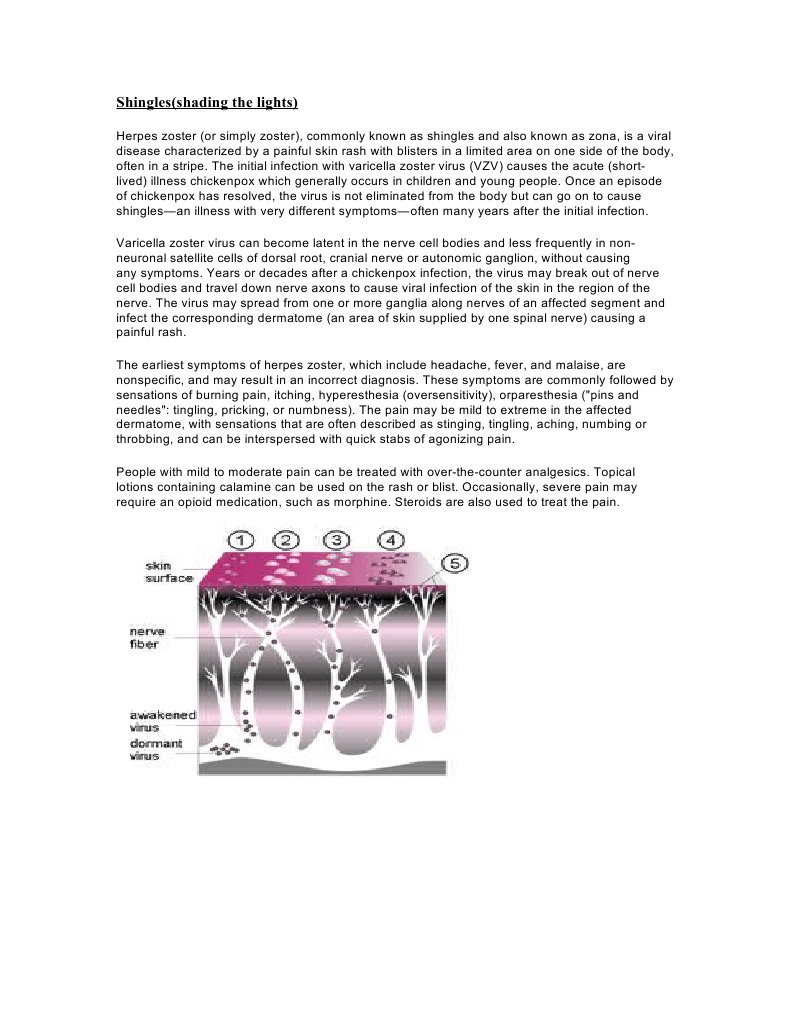 Understanding Shingles Symptoms and Treatment | PDF | Self-Improvement