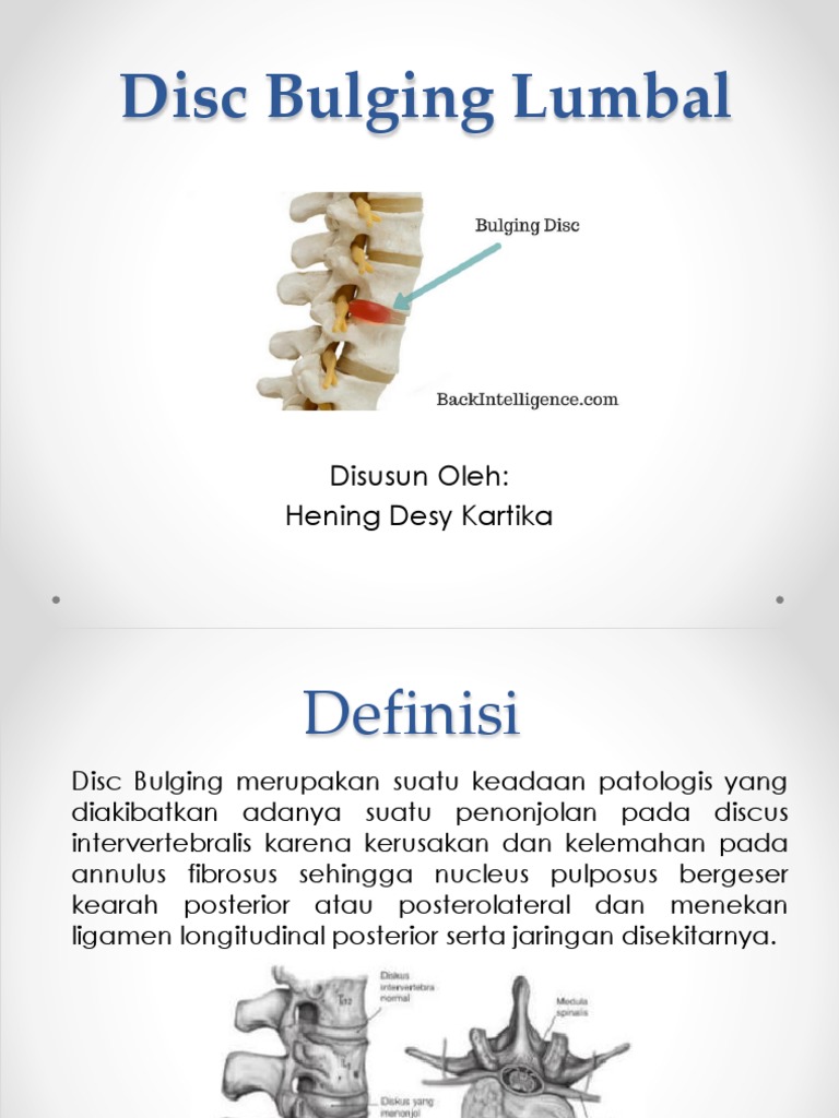 Disc Bulging Lumbal | PDF