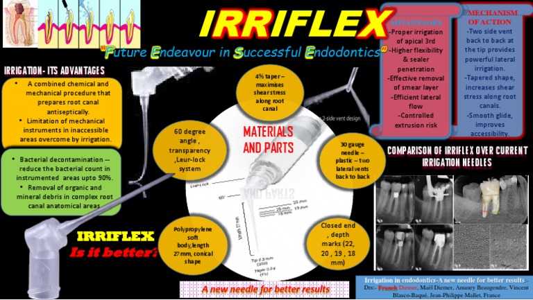 Irriflex Needle: Enhancing Root Canal Irrigation | PDF | Nature