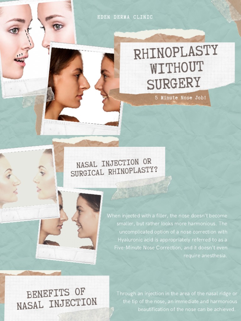Rhinoplasty Without Surgery - 5 Minute Nose Job! | PDF | Human Nose ...