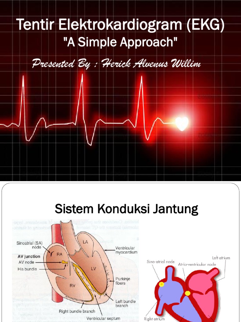 Tentir EKG | PDF