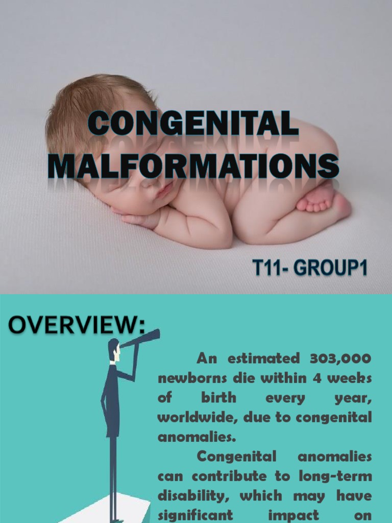 Congenital Malformations | PDF
